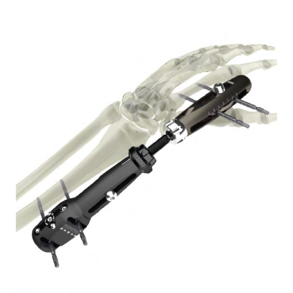 Wrist Fixator
